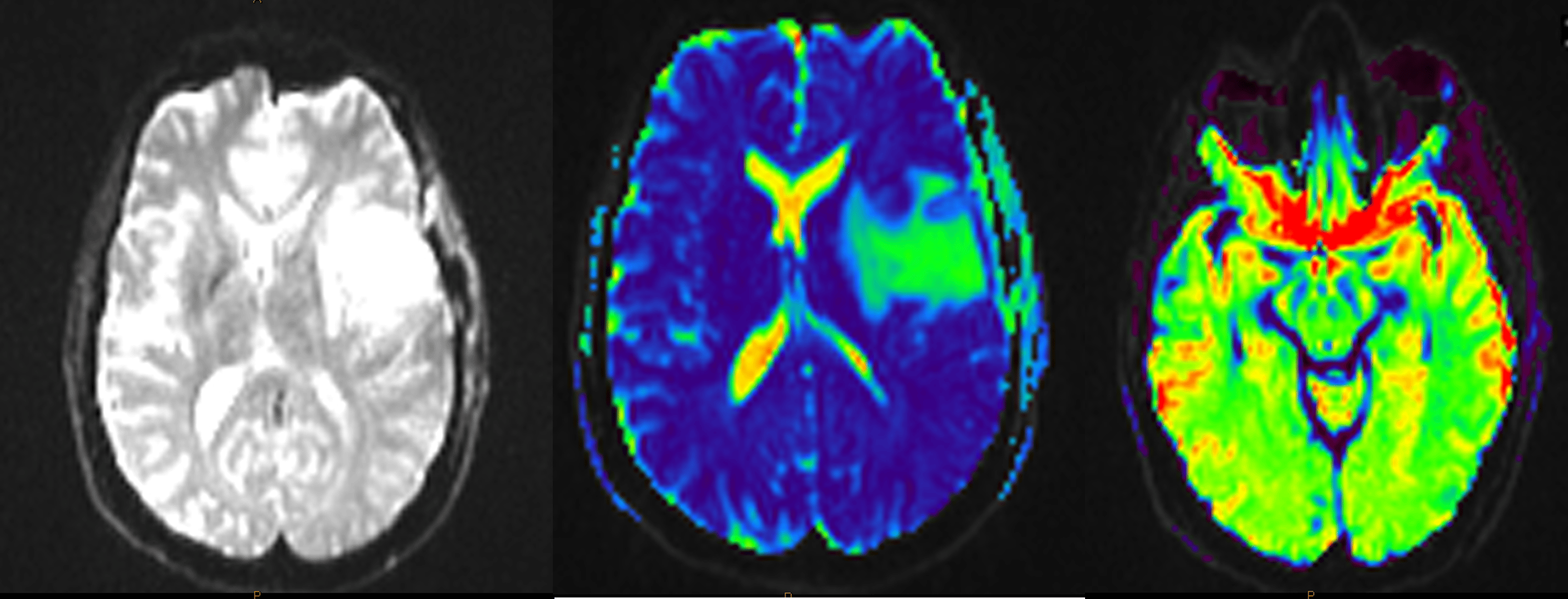 DWI Processing | IB Diffusion