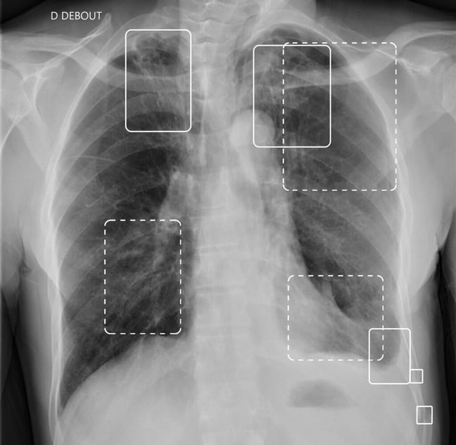 Detection of MSK and Chest Pathologies | SmartUrgences
