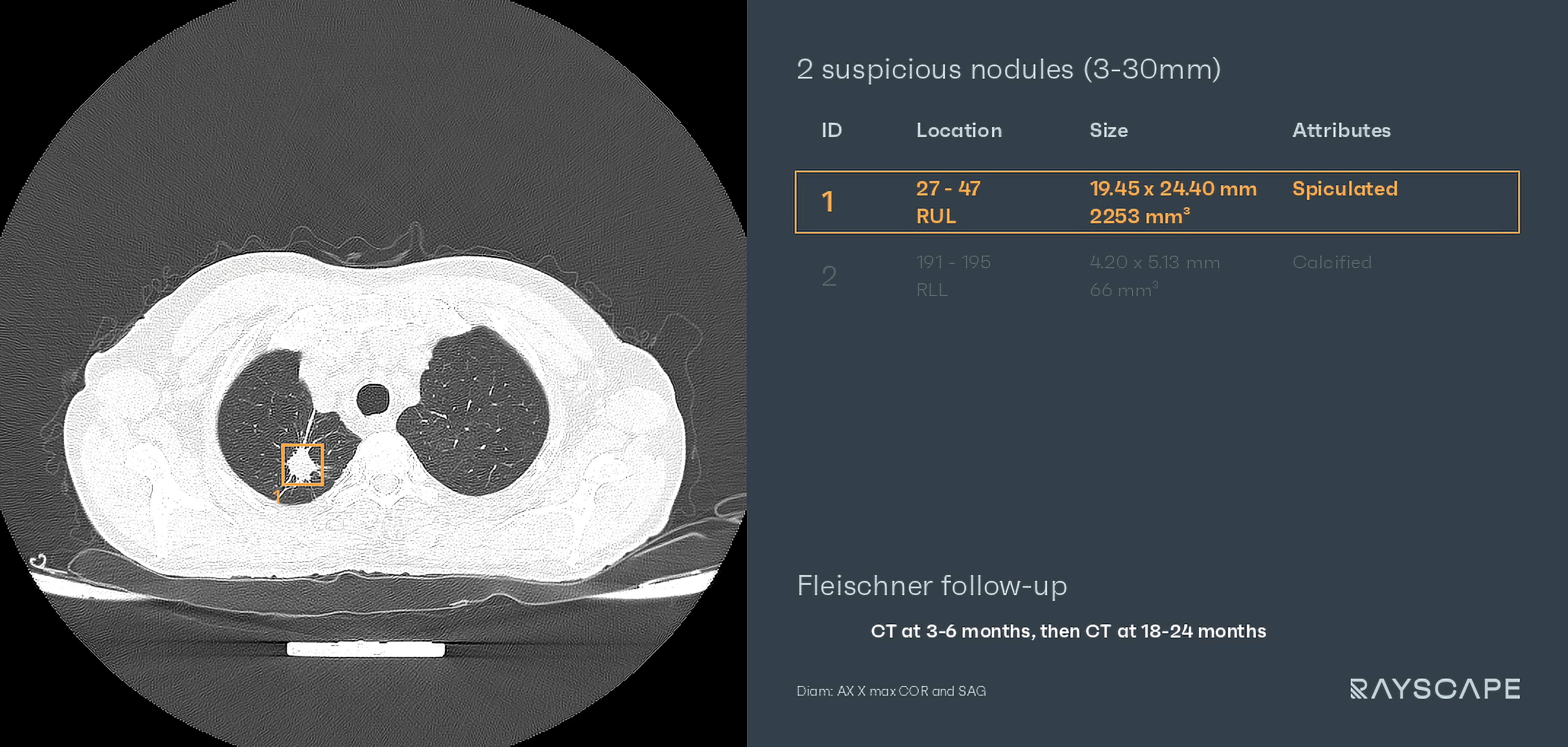 Lung Cancer Detection | Rayscape Lung CT