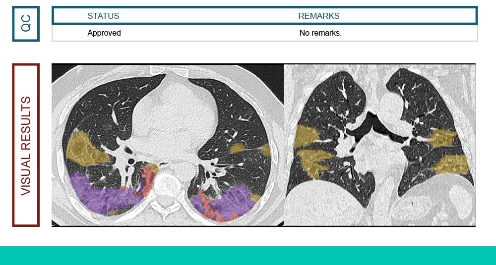 Data-driven insights | icometrix