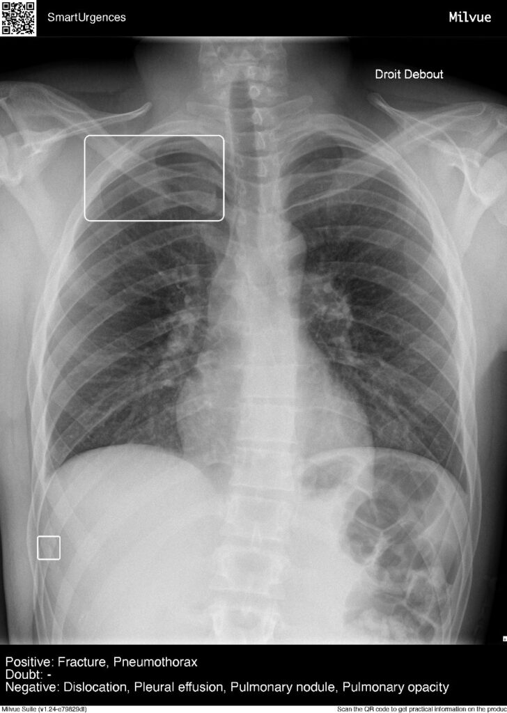Detection of MSK and Chest Pathologies | SmartUrgences